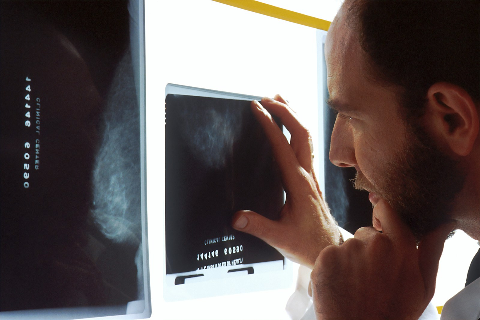 Old European Study Now Reveals New Info On Prostate Cancer – News/ Talk ...